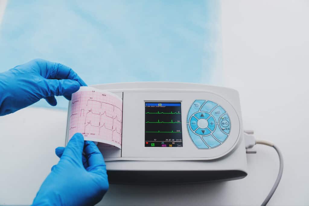 Basic ECG Rhythm Recognition for Nurses - Elite Learning
