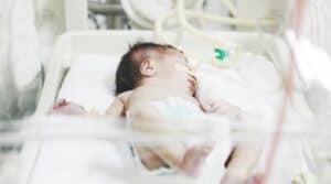 High-Frequency Ventilation in Newborns - Elite Learning